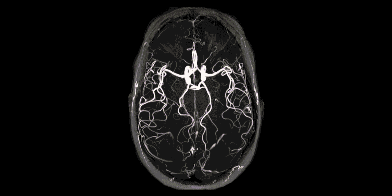 How To Read Mri Images Propertygera How To Read Mri Images Propertygera
