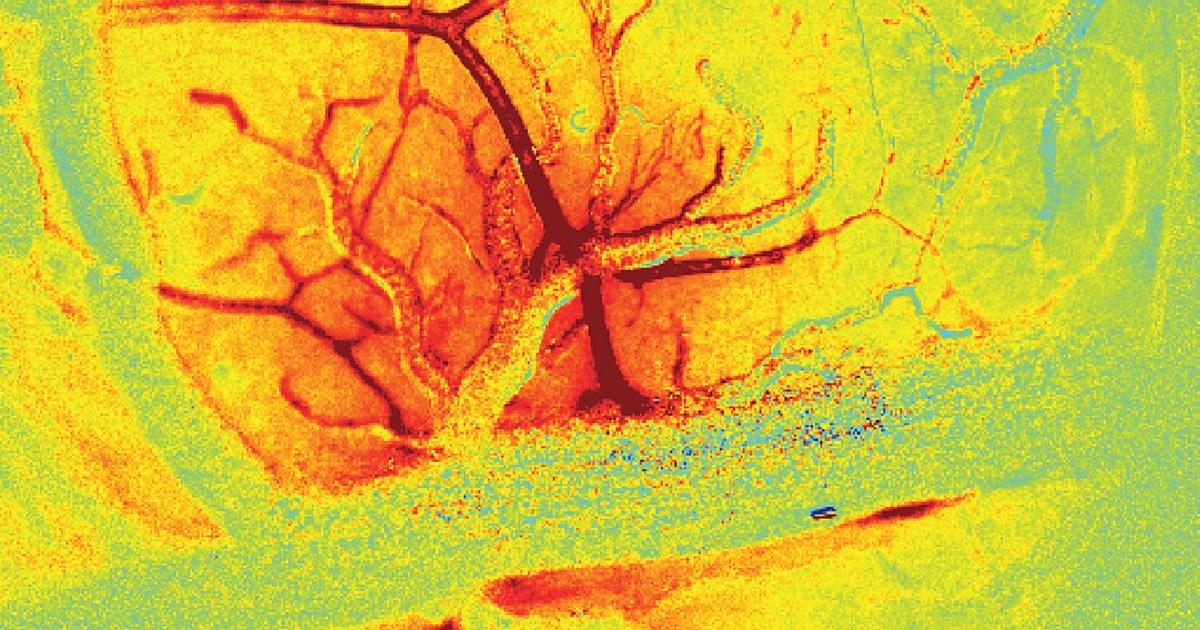 A Mystery of the Infant Brain, Revealed | Columbia Magazine