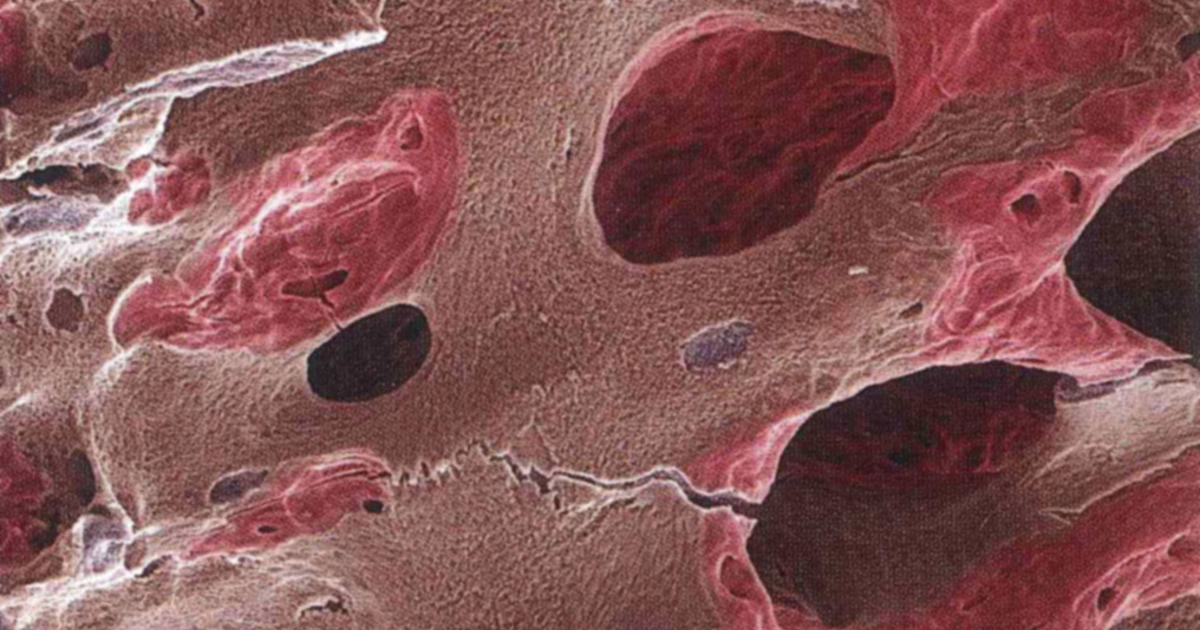 Bone-building Solution | Columbia Magazine