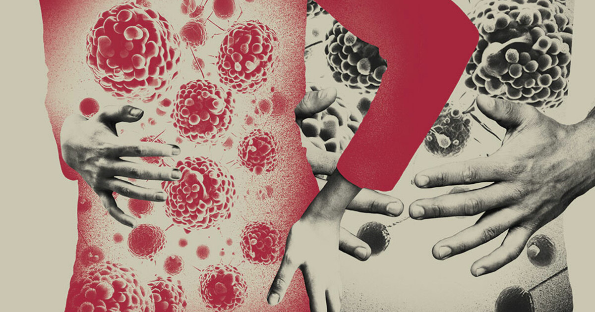 Why Are So Many Younger Adults Getting Cancer? | Columbia Magazine